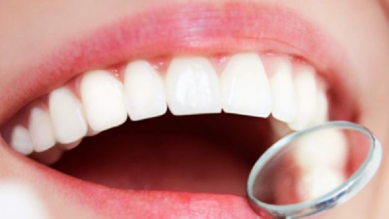 Dhëmbët e rritur në laborator mund të zëvendësojnë mbushjet - Alsat